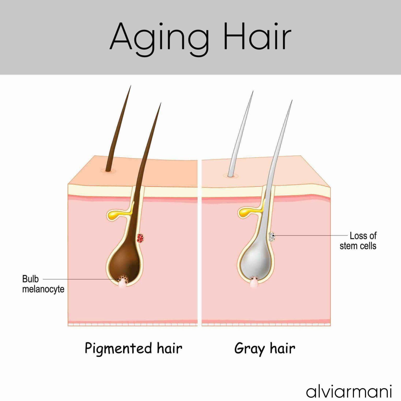 ET 02 for Hair Loss and Graying: Breakthrough Topical Therapy from ...